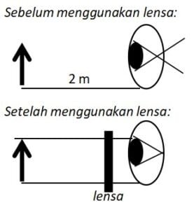 Rumus Kekuatan Lensa Cembung dan Cekung – idschool.net