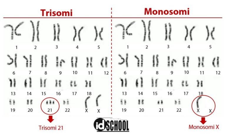 Kelainan Jumlah Kromosom pada Manusia (Trisomi dan Monosomi) – idschool.net